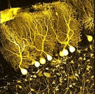 Johannes Purkinje: physiologist with wide interests - Hektoen International