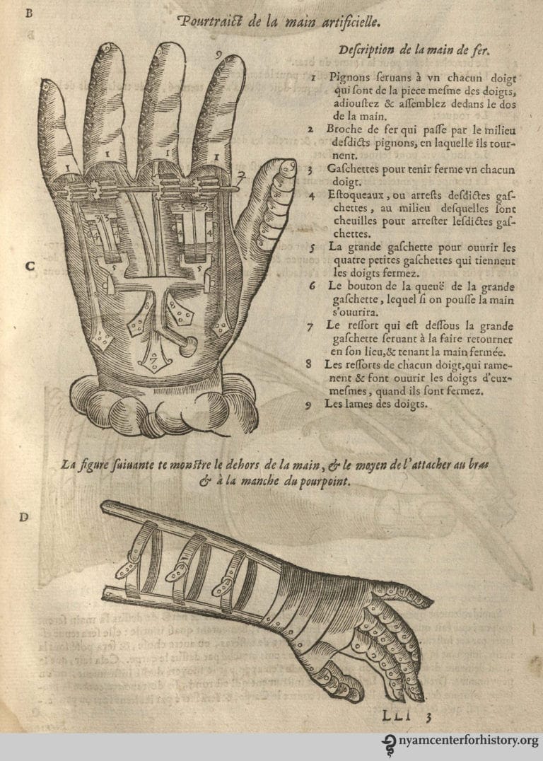 The barber-surgeons: Their history over the centuries - Hektoen ...