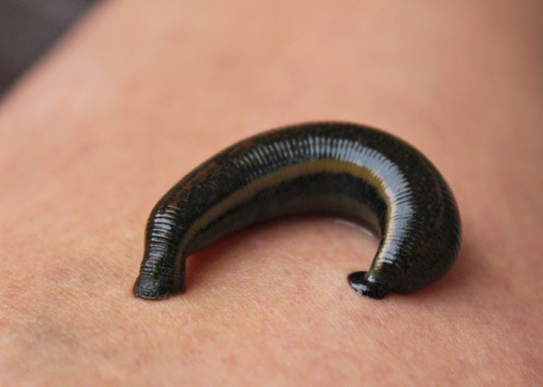 The leech makes a comeback - Hektoen International