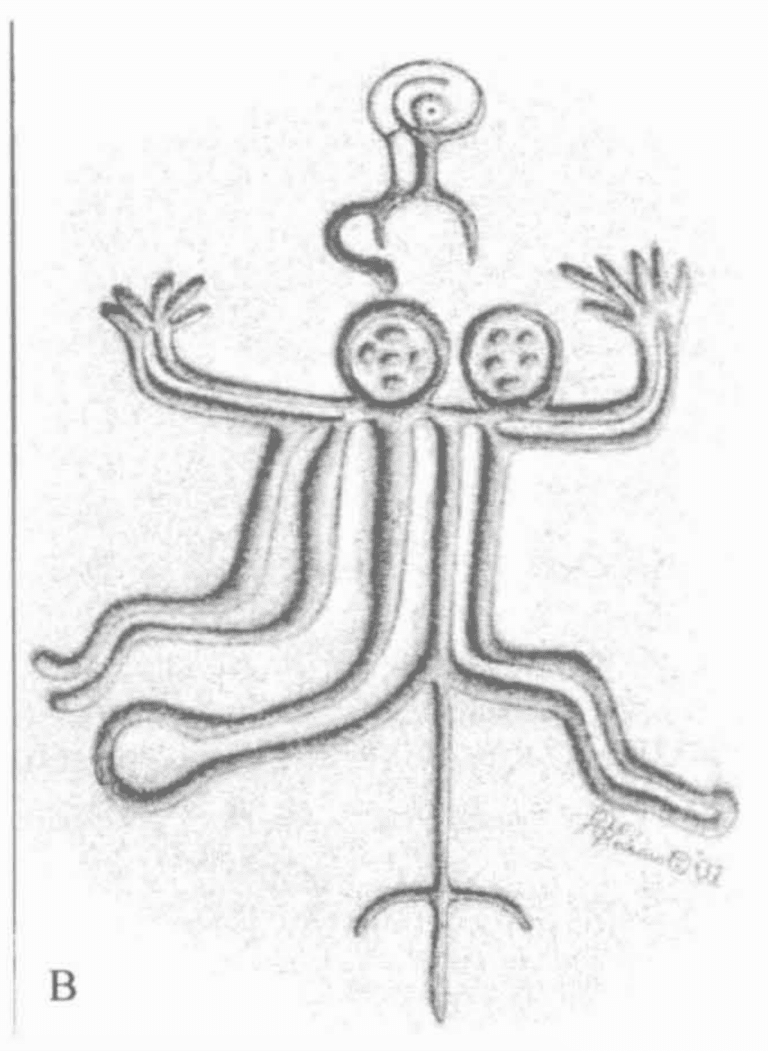 Conjoined twins: Art, ethics, and the media - Hektoen International