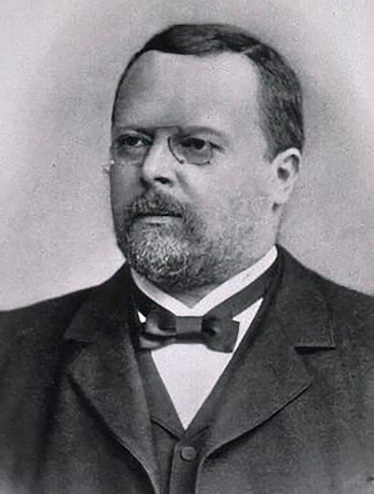 The Rosenbach eyelid sign - Hektoen International