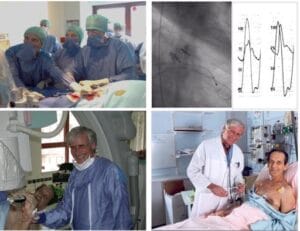 Alain G. Cribier, MD, aortic stenosis, and TAVI - Hektoen International